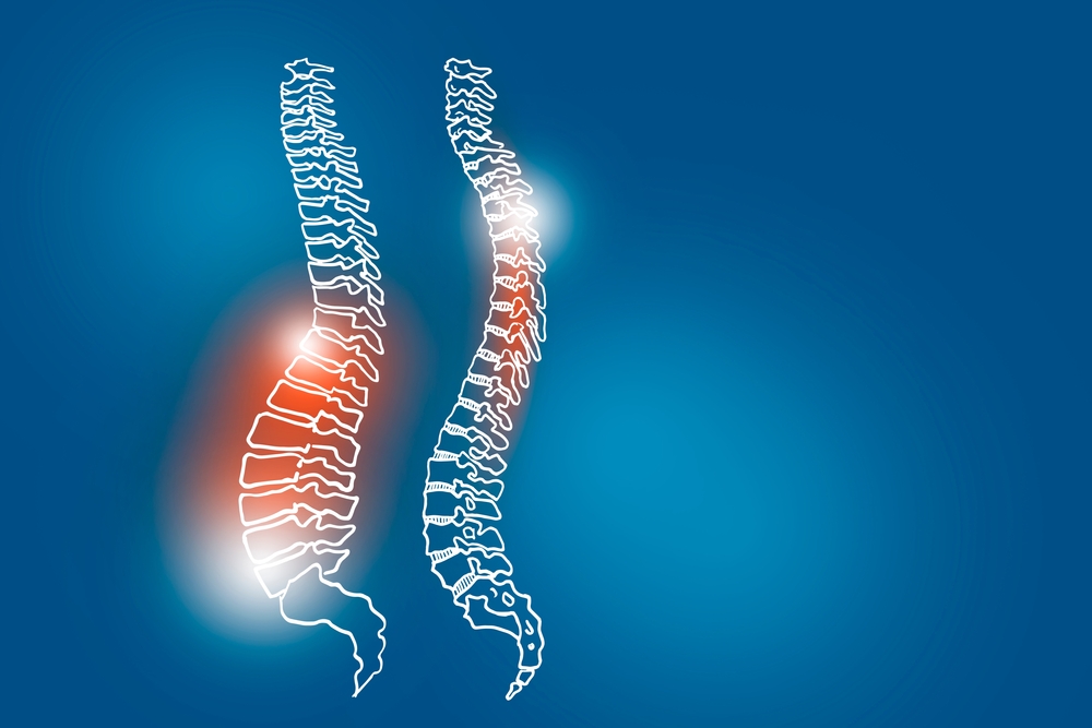 Spinal Instability - AKSIS Special Hospital