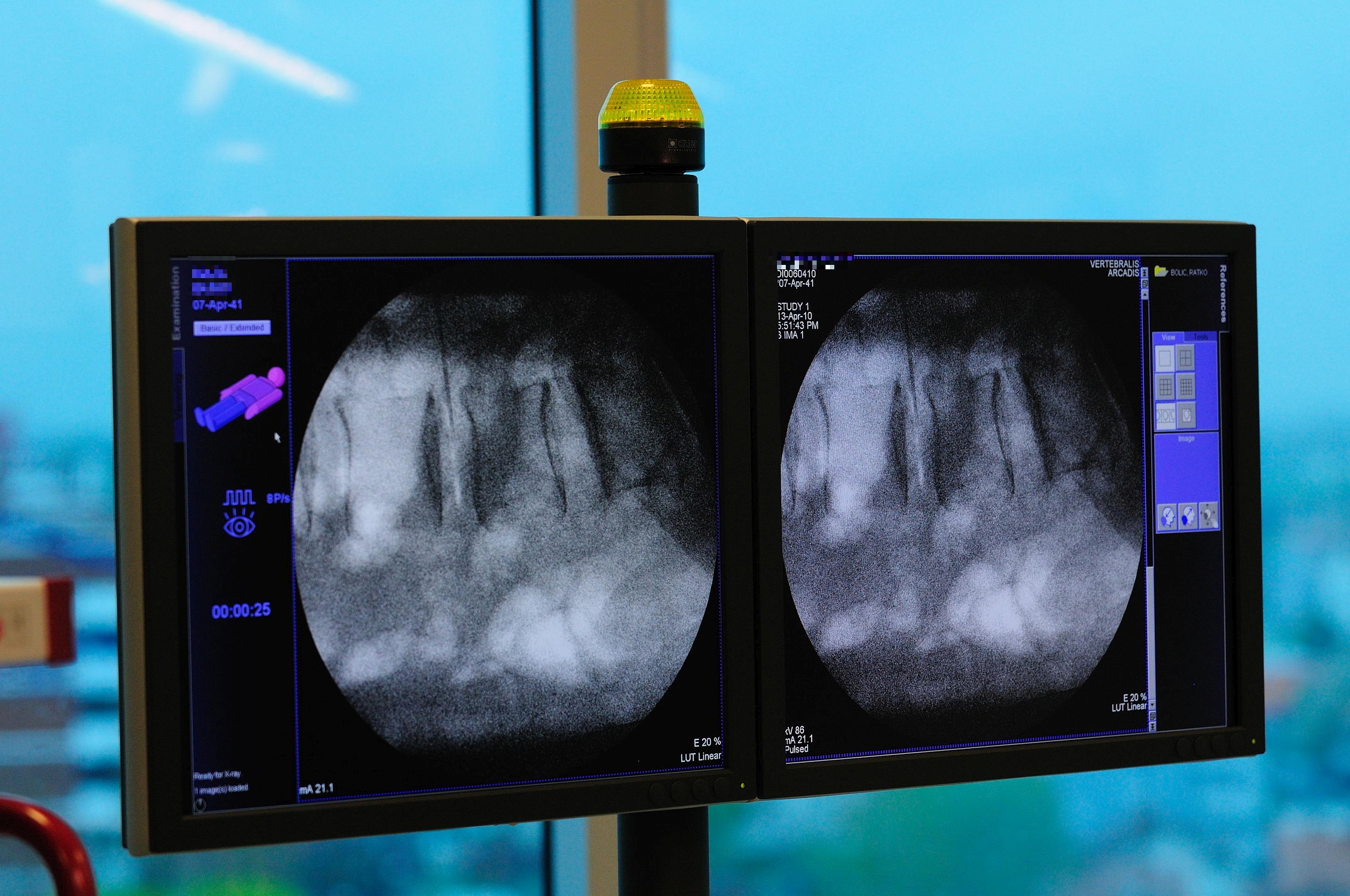 Provocative Discography – Discogram - AKSIS Special Hospital